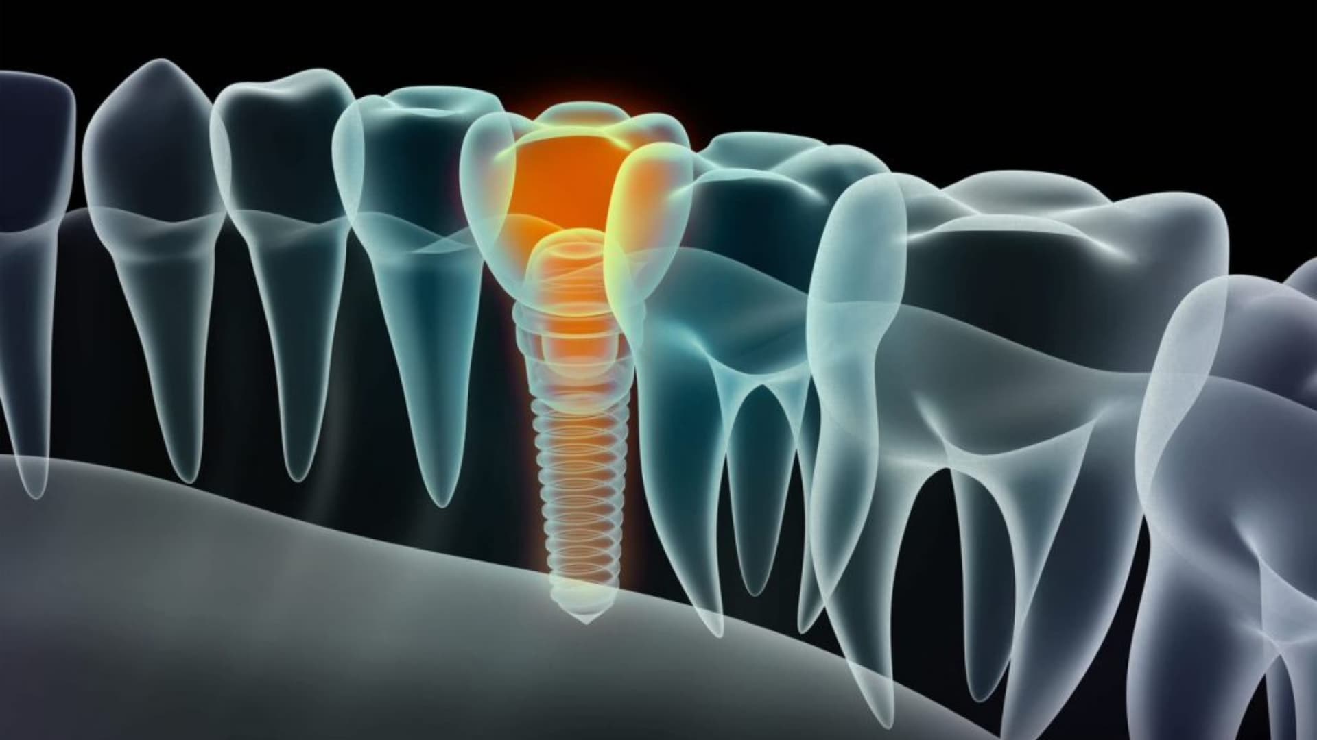 Biomaterial research using MP-SPR and QCMD | BioNavis